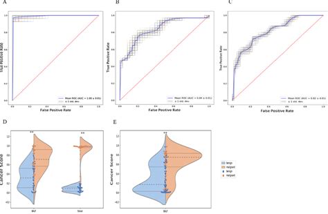 Performance Of The Optimal Model On Diagnosing Benign And Malignant Download Scientific Diagram