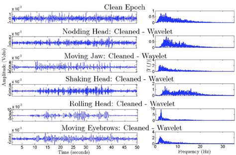 9 Artifact Removal Performed Using The Wavelet Transform On Eeg Epochs Download Scientific