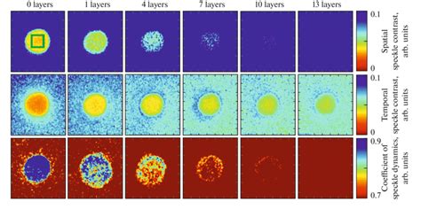 Spatial Speckle Contrast Images Upper Row Temporal Speckle Contrast