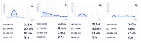 Ics 2019 Abstract 664 The Application Of Mobile App Based Acoustic Uroflowmetry In Real Life