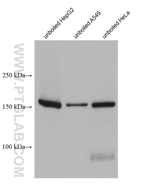 Bsep Antibody 67512 1 Ig Proteintech
