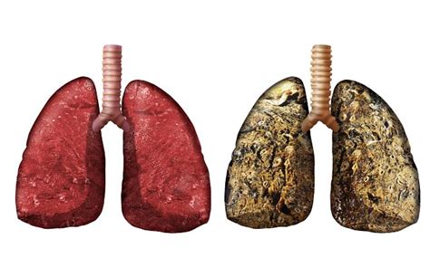 Smoking Lungs Before And After