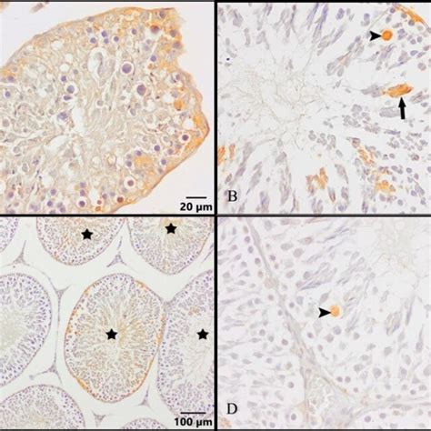 Apoptotic Cells In Testicular Sections Belonging To Experimental Groups