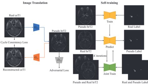 논문 리뷰 Image Translation Based Unsupervised Cross Modality Domain