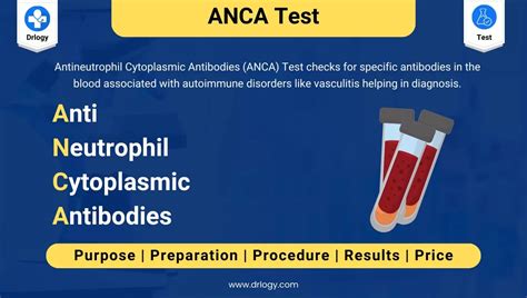 Top Anca Test Keywords Test Blogs Drlogy Top Anca Test Keywords Test Blogs Drlogy