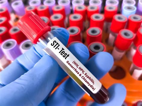 Une Nouvelle Maladie Sexuellement Transmissible Se Propage En Europe