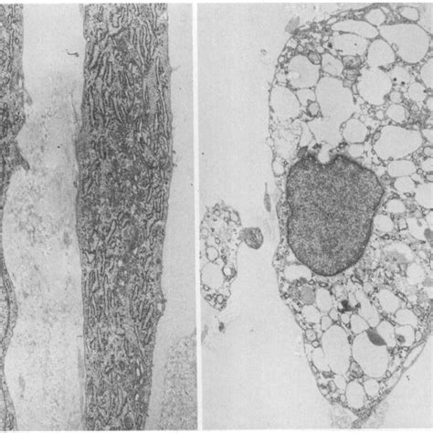 A Left An Electron Micrograph Shows Fibroblast Like Cells With
