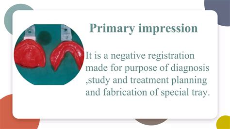 Impression For Complete Denture Pptx Dental Health Diseases And Conditions