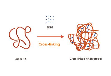 Artibest® Extend 1 Dose Intra Articular Injection Mbi Medical Device Manufacturer Of