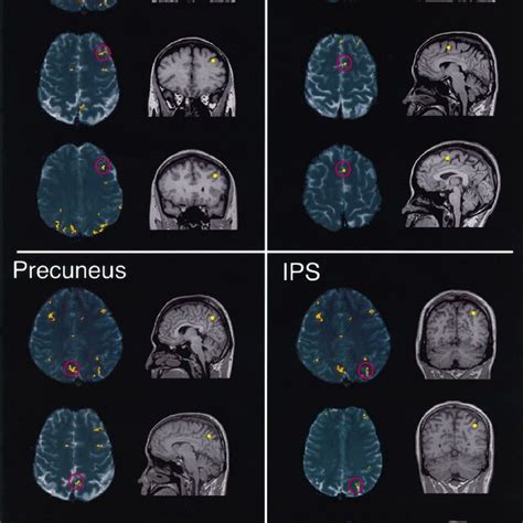 Four Cortical Areas Related To Learning The Locations Of Activated Download Scientific Diagram