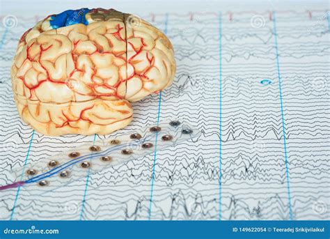 Ondas Cerebrales De La Grabaci N Del Modelo Y Del Electrodo Del Cerebro Humano En El Fondo De