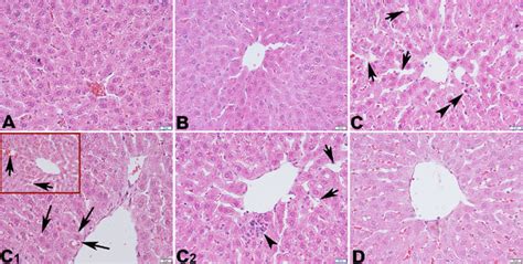 hematoxylin and eosin staining of liver tissue sections of control a