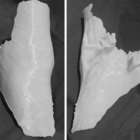 5 3d Printed Haptic Model Of The Ankle Defect Alongside The Reverse Download Scientific Diagram