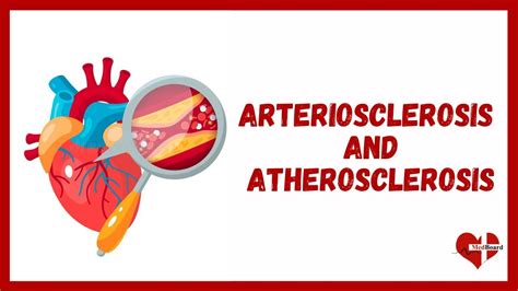 Arteriosclerosis Vs Atherosclerosis Are They Different 49 Off