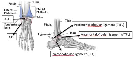 Medial Tubercle Of Talus