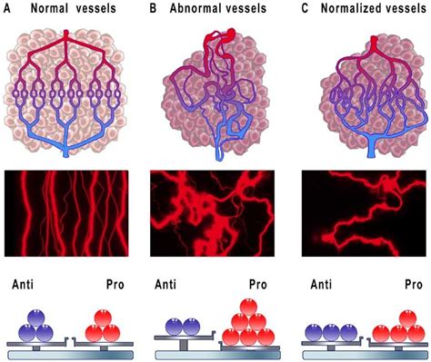 Hypothesis Of Tumor Vessel Normalization A Angiogenesis In Healthy Download Scientific