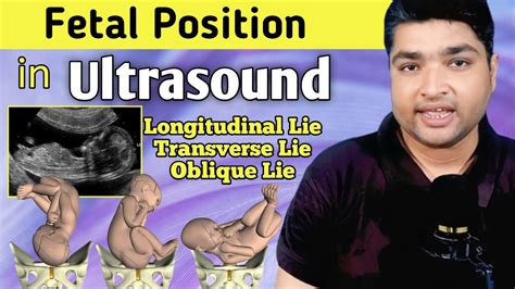 Fetal Lie Position And Presentation In Ultrasound Ultrasound Kaise