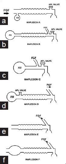 Classification Of Mapleson System A To F Download Scientific Diagram