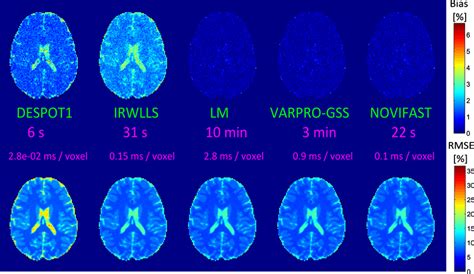 Bias And Rmse Maps Of A Mid Axial Slice Of A Synthetic 3d T 1 Map Snr