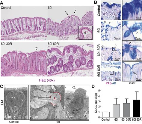 Goblet Cells Colon