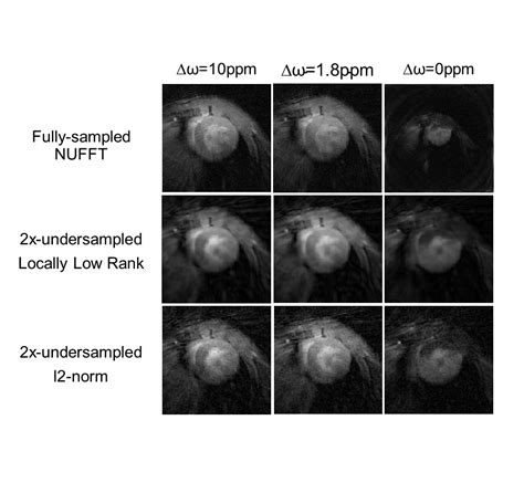 Figure 1 Representative Reconstructed Images At 2x Undersampling
