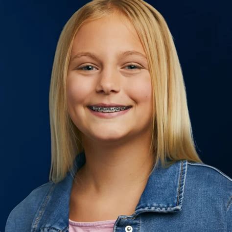 Traditional Metal Braces Lakeside Orthodontics