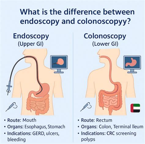 Endoscopy Vs Colonoscopy Purpose Procedure And Cost In Uae