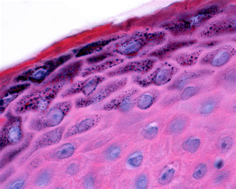 20 Stratum Granulosum Foto Stok Potret And Gambar Bebas Royalti Istock