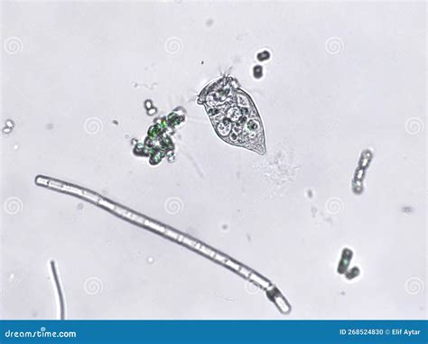 Freshwater Aquatic Zooplankton And Algae Under Microscope View Stock