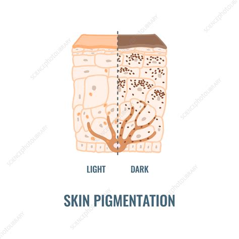 Skin Pigmentation Illustration Stock Image F0365675 Science Photo Library