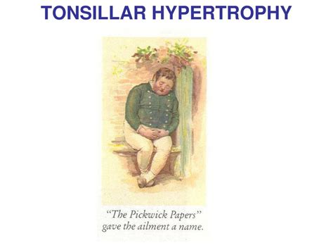 Ppt Critical Care Medicine Powerpoint Presentation Free Download