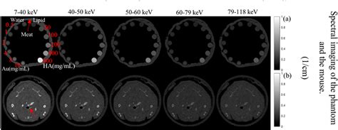 Figure 2 From Spectral Photon Counting Ct Imaging Of Gold Nanoparticle Labelled Monocytes For