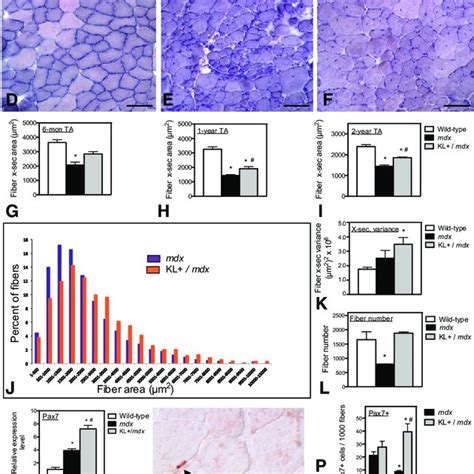 Klotho Transgene Expression Reduces The Expression Of Transcripts Download Scientific Diagram