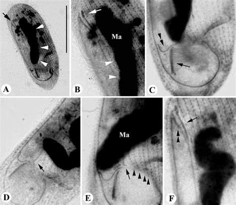 A F Photomicrographs Of Pleuronema Wiackowskii Sp N After Protargol