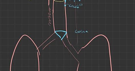 Ap300 Album On Imgur