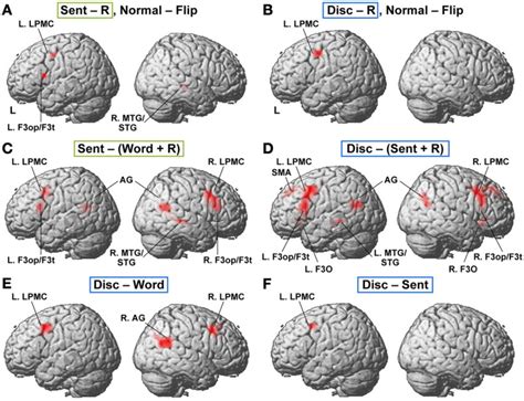 Lateralization And Functional Localization Of Cortical Activations