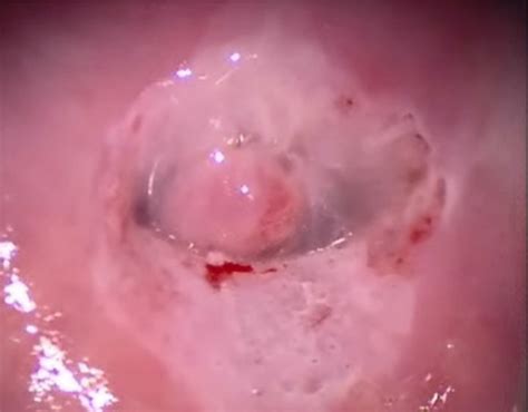 Evaluation Of Factors Affecting Margin Positivity And Persistent