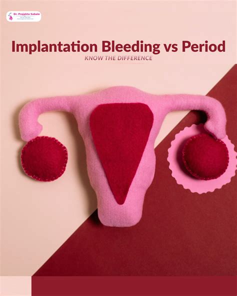 Implantation Bleeding Vs Period Know The Difference Dr Prajakta Sabale