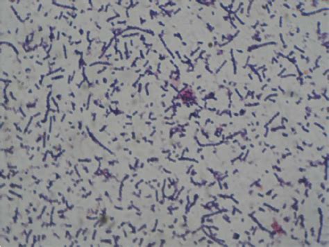 Streptococcus Bacteria Gram Stain Streptococcus Pneumonia Fungus