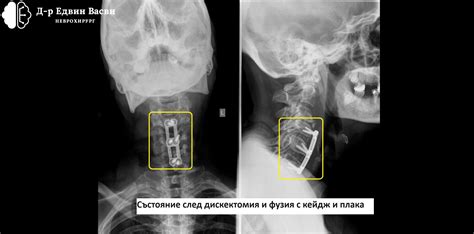 Д р Едвин Васви Неврохирург Varna