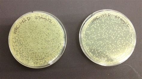 Colony Count Microbial Agar Dilution Count Colony Forming Units
