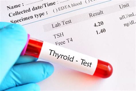 Thyroid Test Complete Guide Symptoms Diagnosis Nayab Labs And Diagnostic Centre