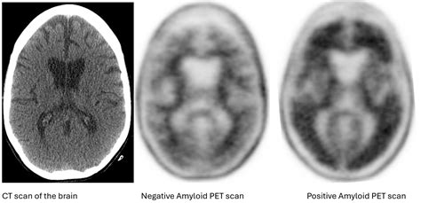 Neurology Services —
