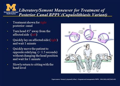 Anterior Canal Repositioning Maneuvers Bppv And Particle Repositioning