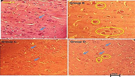 Representative Photomicrograph Of The Prefrontal Cortex Pyramidal Cells Download Scientific
