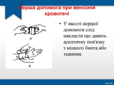 Невідкладна домедична допомога Основи здоров`я 9 клас презентация онлайн