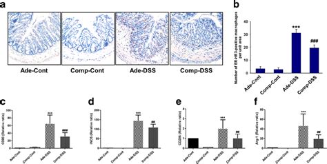 Comp Ang1 Prevents Macrophage Infiltration In A Dss Induced Colitis Download Scientific Diagram