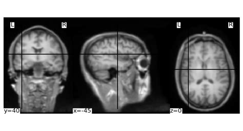 Working With Nifti Images — Neural Data Science In Python