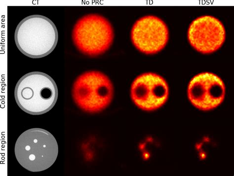 Axial View Of The Nema Nu 4 Phantom For The Uniform Cold And Rod Download Scientific Diagram