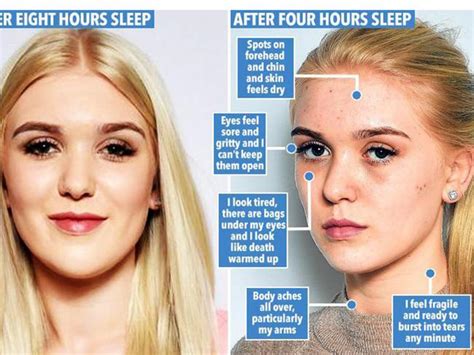 The Damaging Effects Of Sleep Deprivation Gold Coast Bulletin